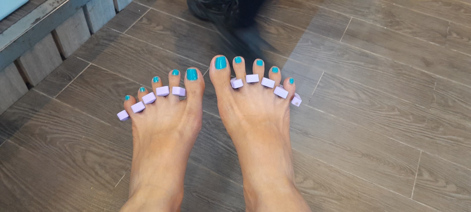 yocchiさんのダイアリー：先週、半年に一回のCTスキャン受けてきました。結果 | Peer Ring - なかまと話そう！女性特有のがん