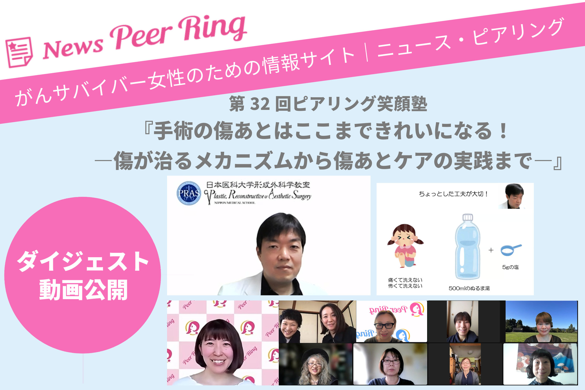 ピアリング事務局さんのイベント：[[第32回ピアリング笑顔塾 「手術の傷あとはこ | Peer Ring - なかまと話そう！女性特有のがん
