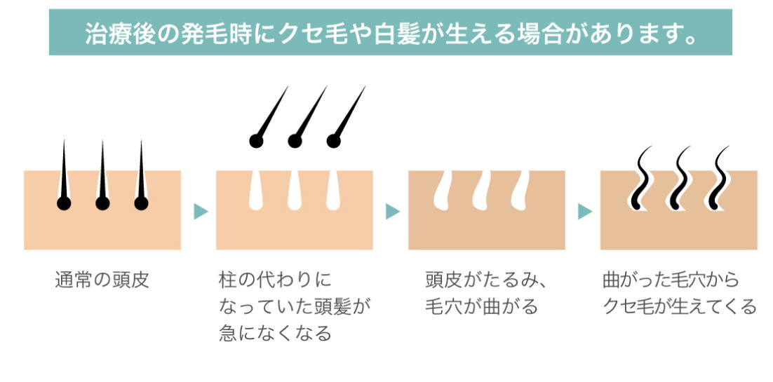 ピアリング事務局さんのダイアリー：#NewsPeerRing #アクアドール # | Peer Ring - なかまと話そう！女性特有のがん